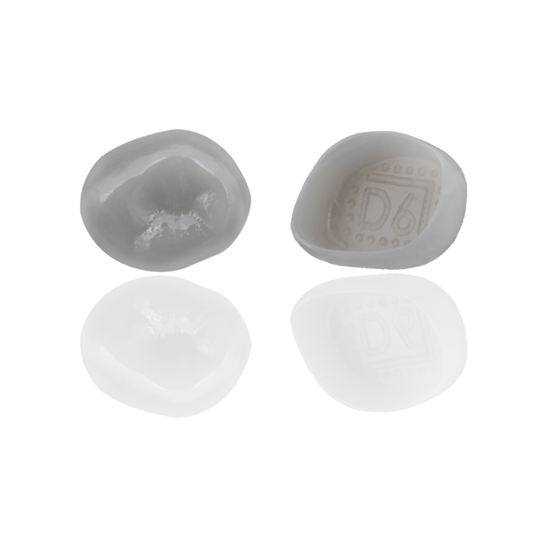 Primary first molar refills | Kidsedental